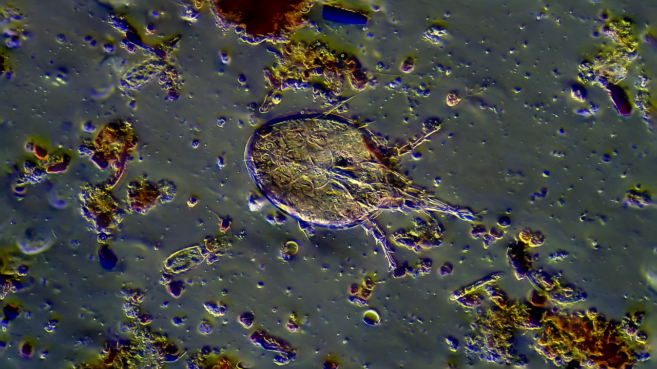 Kutu Air - Gejala, Penyebab dan Mengobati — Rumah Sakit Budi Medika